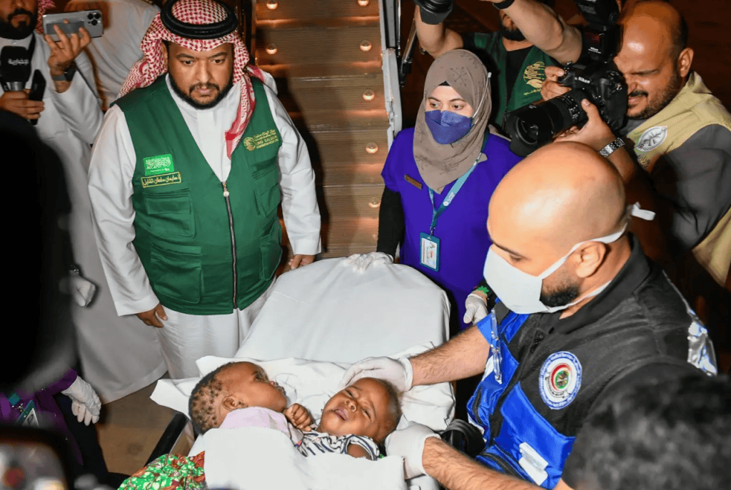 UN Declares Nov. 24 ‘World Conjoined Twins Day’ upon Saudi Arabia’s ...